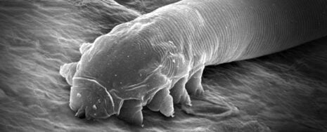 Demodex: Seu rosto está coberto por milhares deles, e eles nem sempre ...